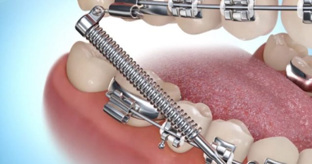 Patients Resources | Norwest Orthodontics